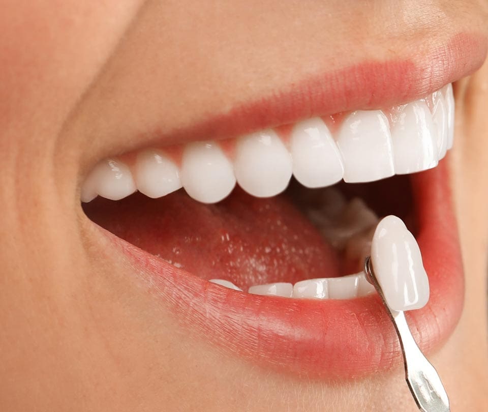 Advanced Implants | Manningtree Dental Practice Dental & Implant Centre ...