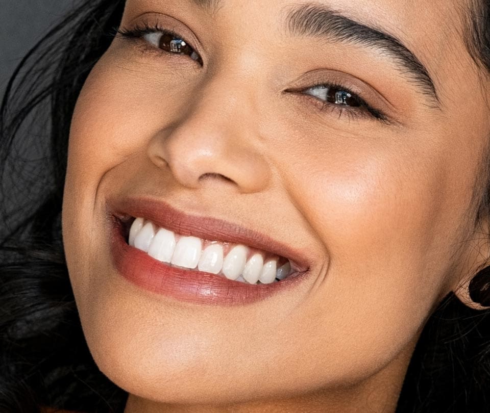 Composite Edge Bonding | Manningtree Dental Practice Dental & Implant ...